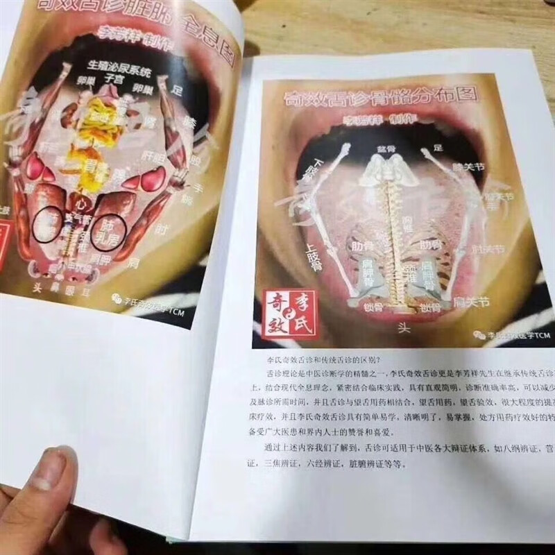 中医舌诊书籍奇效舌诊秘传心法李芳祥新书 彩图高清 彩图高清