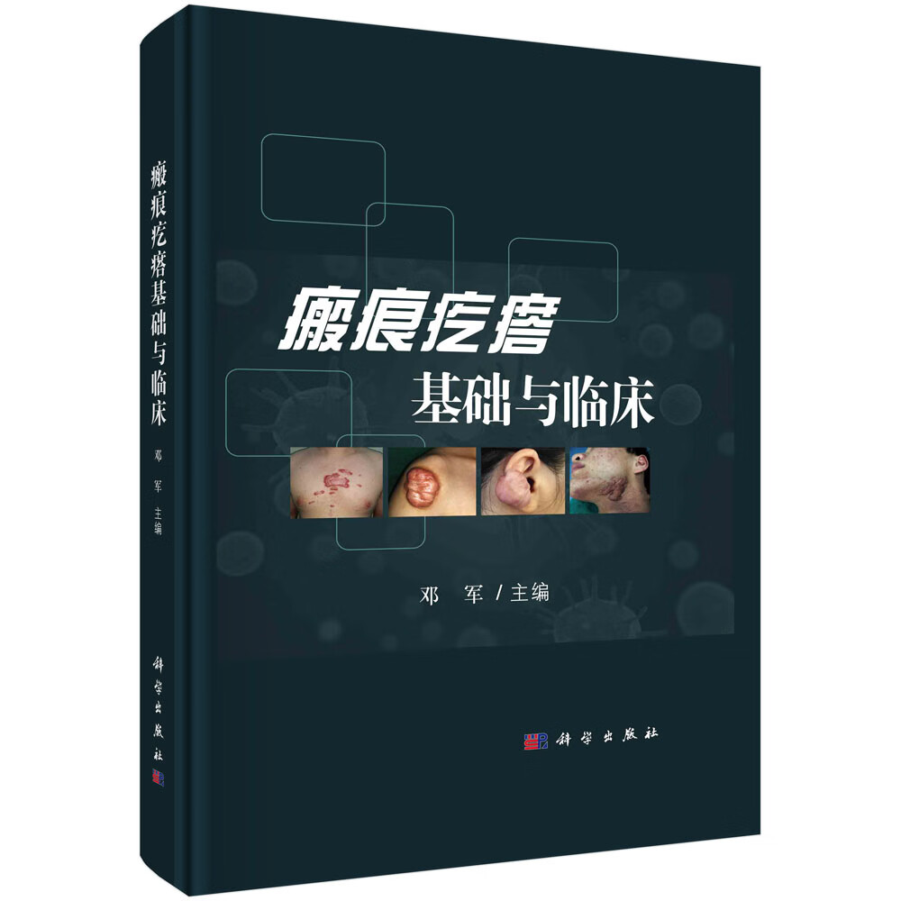 瘢痕疙瘩基础与临床/邓军
