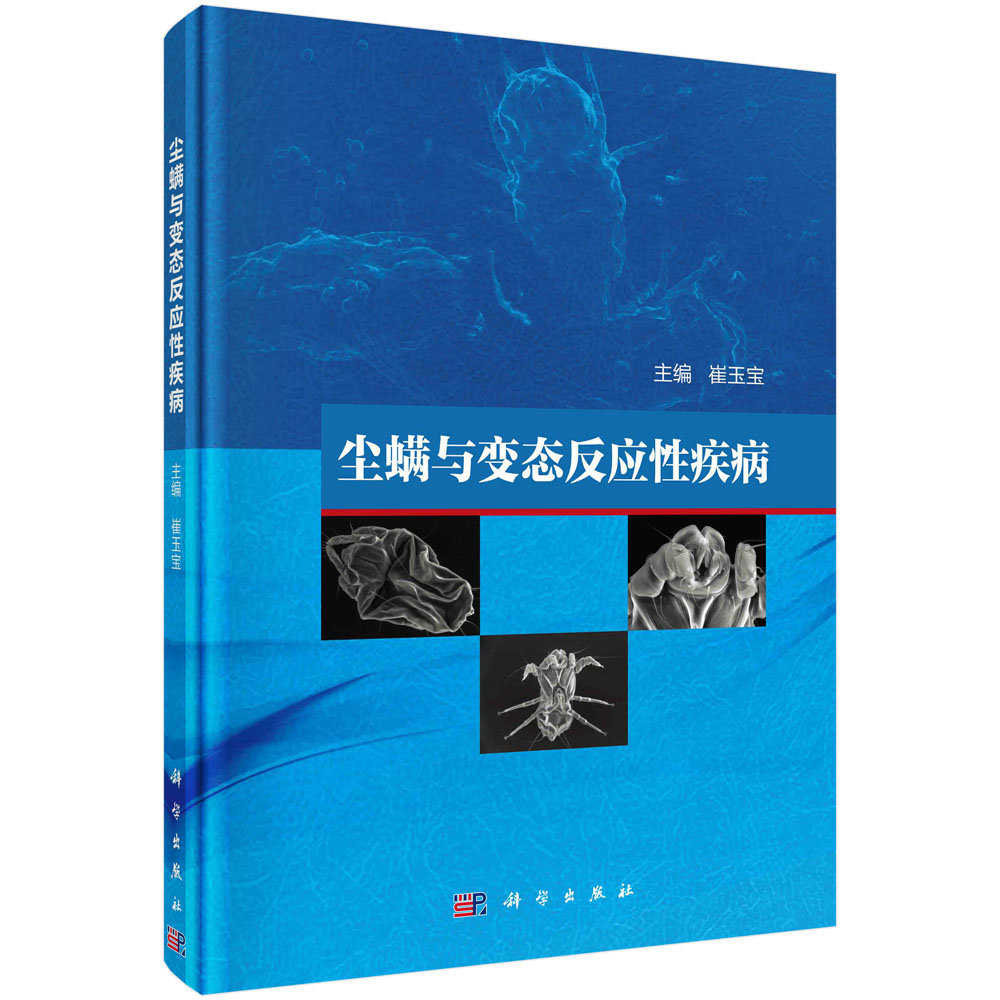尘螨与变态反应性疾病9787030602978POD定制书 EGS