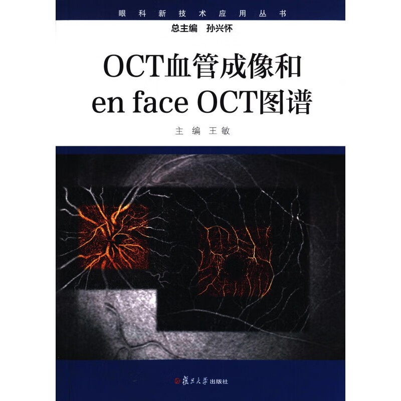 OCT血管成像和enface OCT图谱（精装版）（眼科新技术应用丛书）