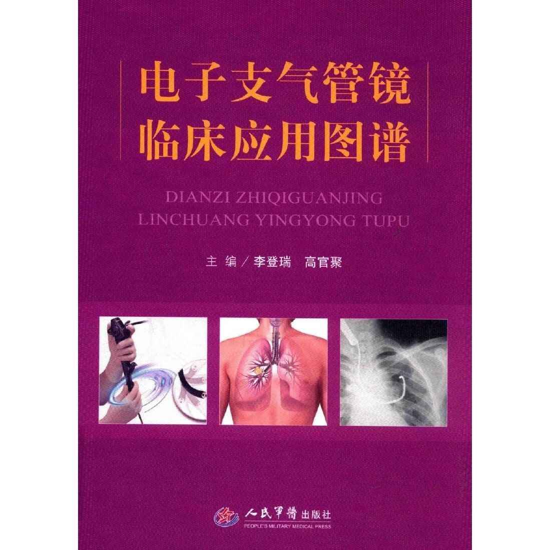 电子支气管镜临床应用图谱_李登瑞,高官聚