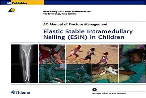 Elastic Stable Intramedullary Nailing (ESIN) in