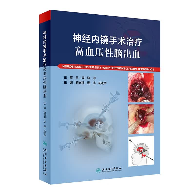 神经内镜手术治疗高血压性脑出血