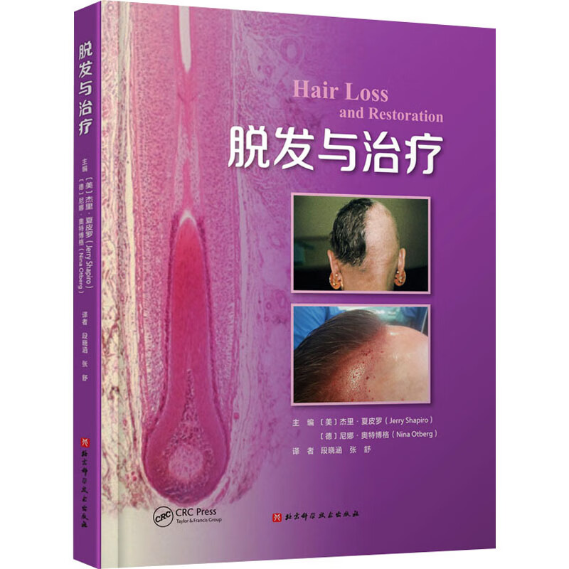 脱发与治疗 图书