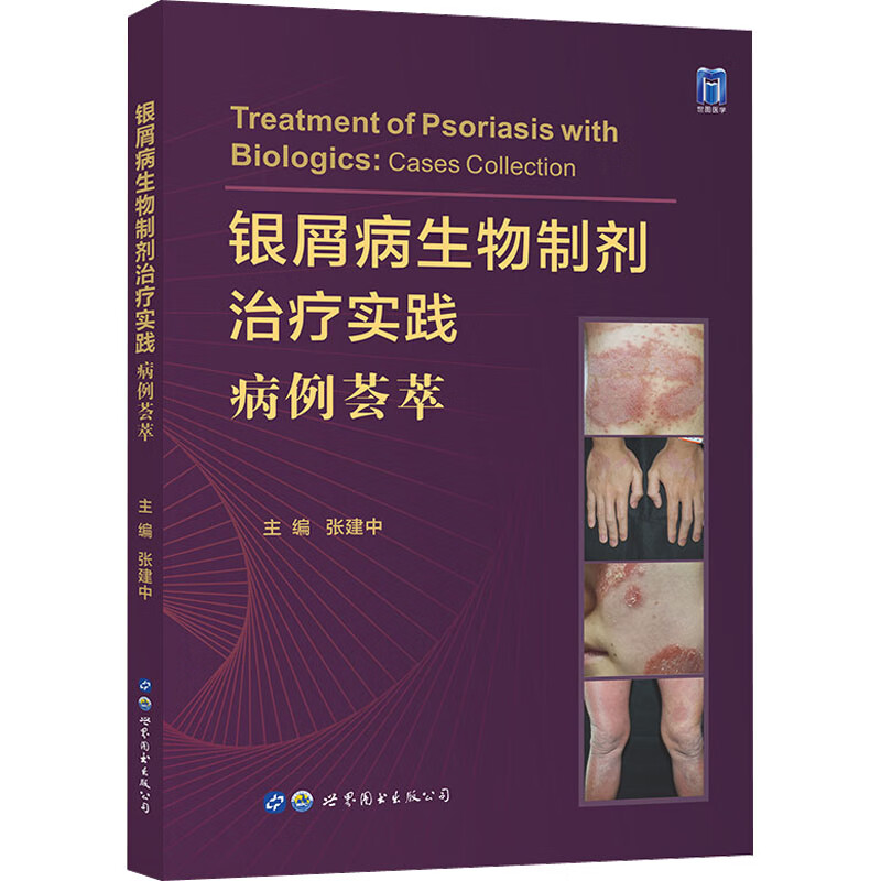 银屑病生物制剂治疗实践 病例荟萃 图书