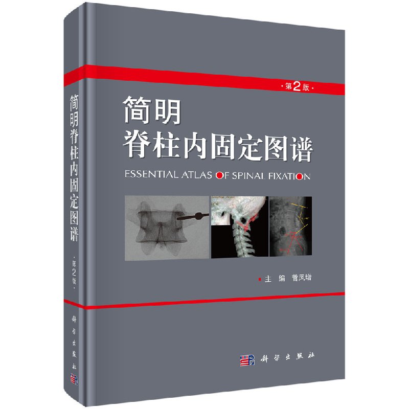 简明脊柱内固定图谱（第2版）