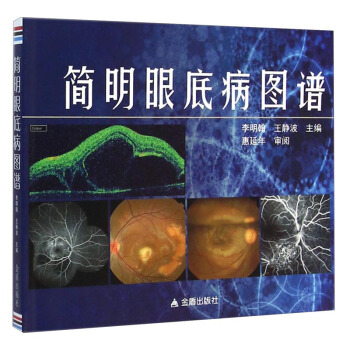 简明眼底病图谱
