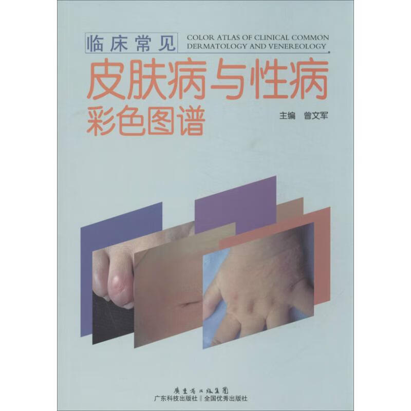 临床常见皮肤病与性病彩色图谱 曾文军 编 书籍