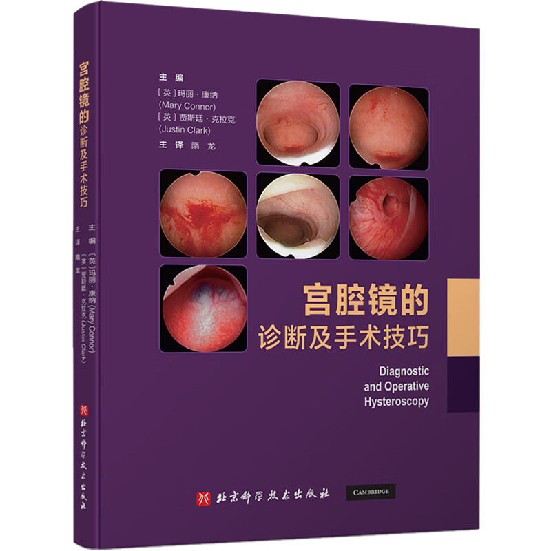 宫腔镜的诊断及手术技巧 图书