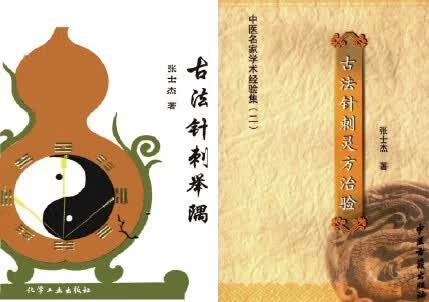 古法针刺举隅+古法针刺灵方治验 张士杰著2本针灸 2本套