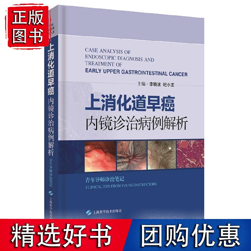 上消化道早癌内镜诊治病例解析