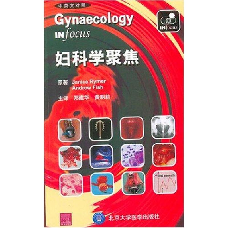 妇科学聚焦