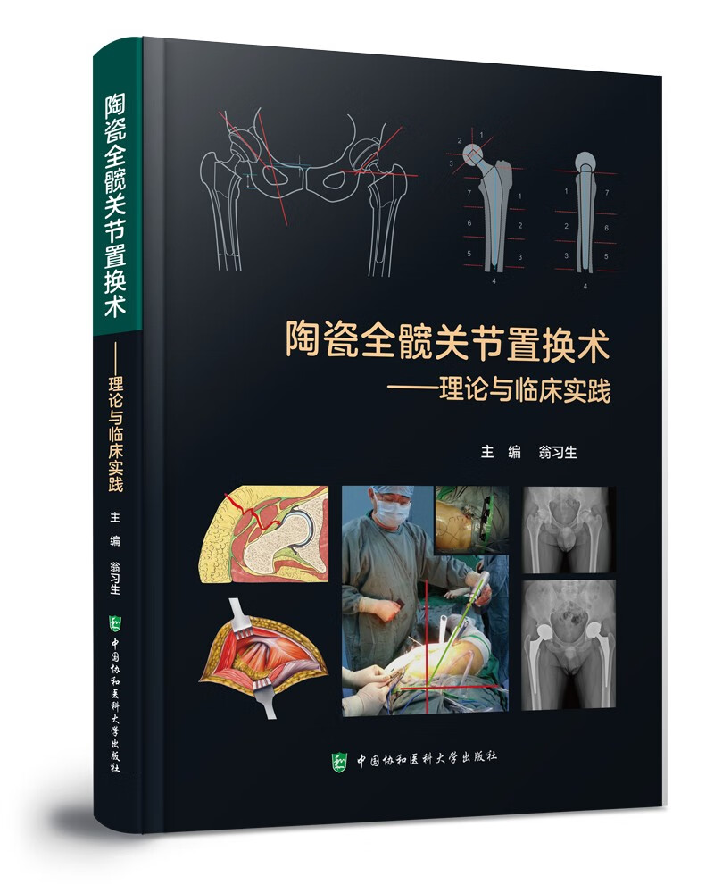 陶瓷全髋关节置换术——理论与临床实践