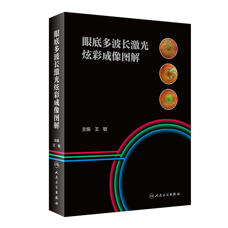 【现货】眼底多波长激光炫彩成像图解