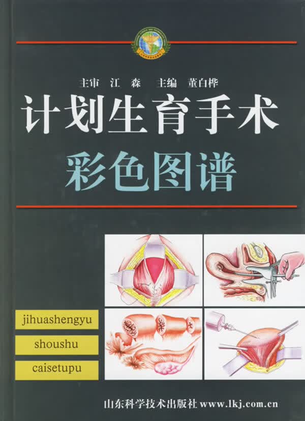 计划生育手术彩色图谱 董白桦 主编