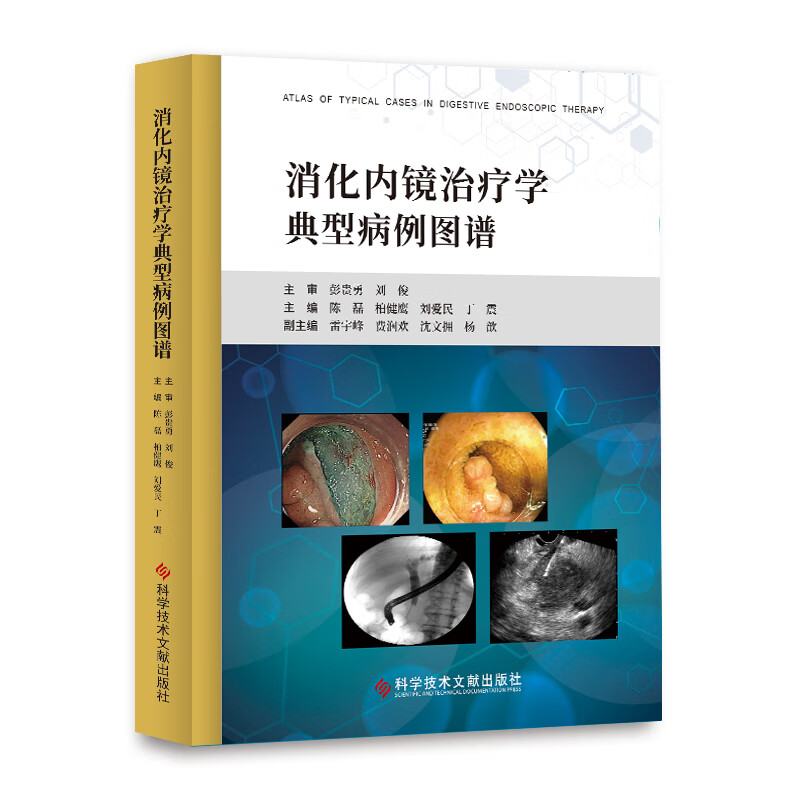 消化内镜治疗学典型病例图谱(精)