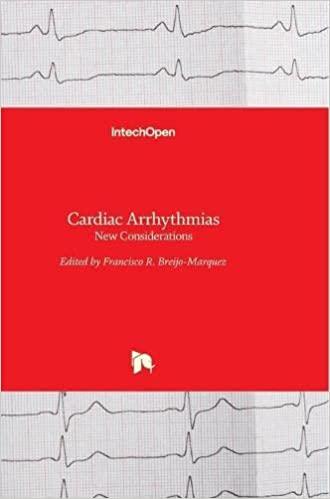 Cardiac Arrhythmias - New Considerations