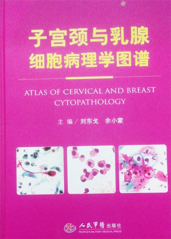 子宫颈与乳腺细胞病理学图谱 刘东戈,余小蒙