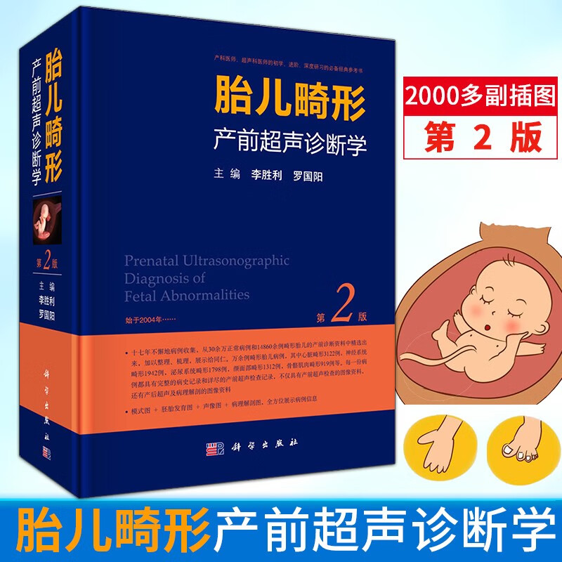 胎儿畸形产前超声诊断学第2版第二版 李胜利罗国阳 超声医学 妇产超声科医胎儿畸形超声诊断医学书籍