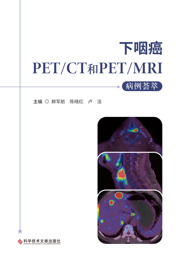 下咽癌PET/CT和PET/MRI病例荟萃
