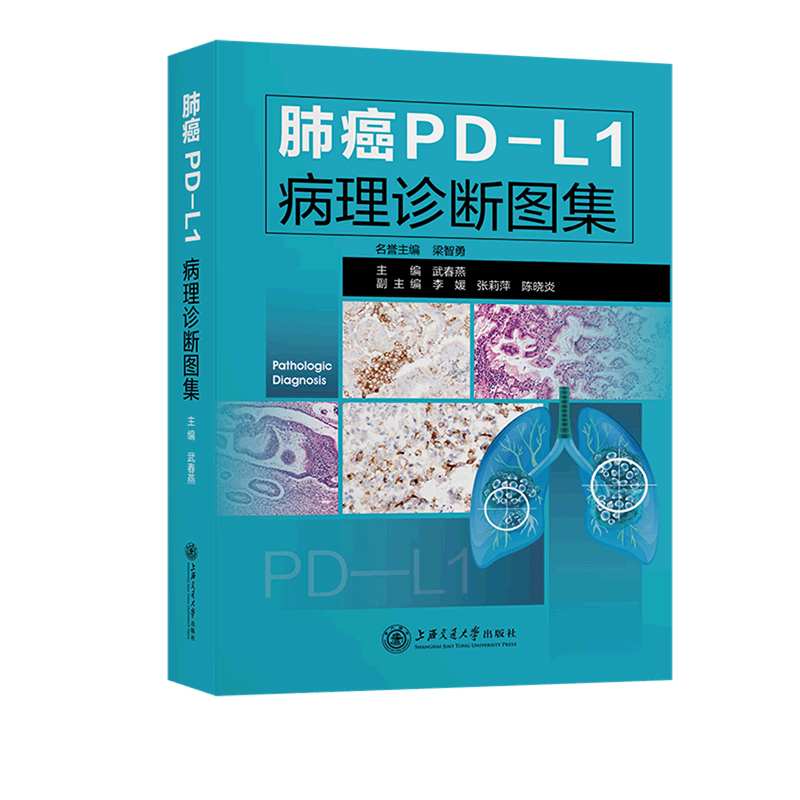 肺癌PD-L1病理诊断图集(精)