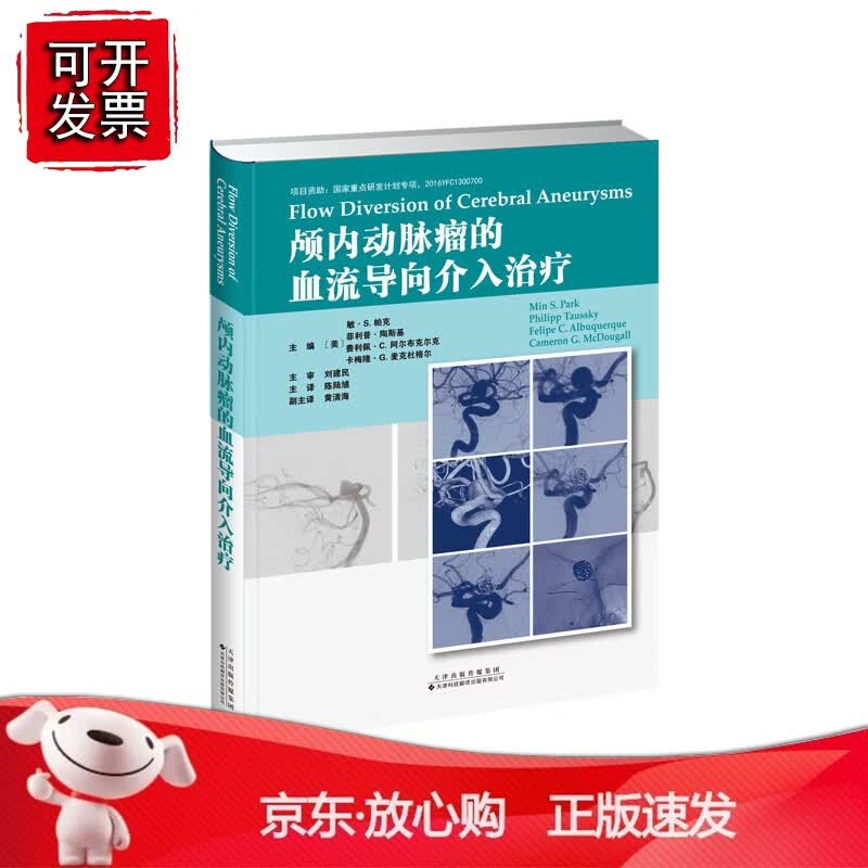 颅内动脉瘤的血流导向介入治疗