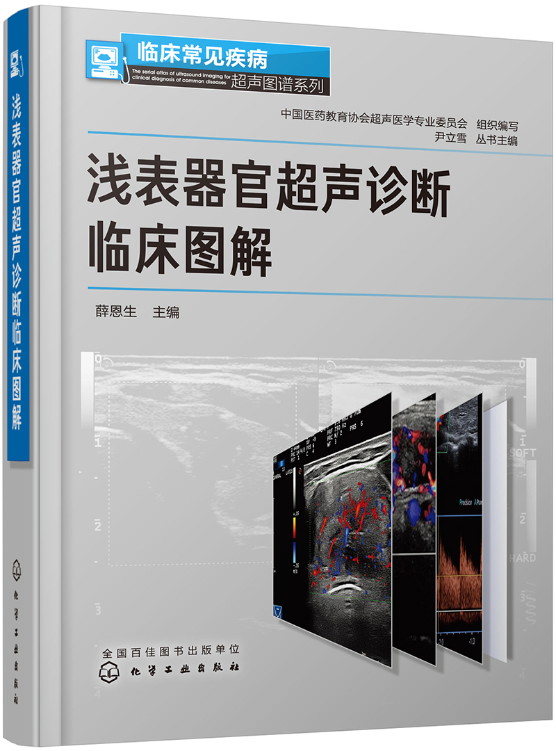 临床常见疾病超声图谱系列--浅表器官超声诊断临床图解