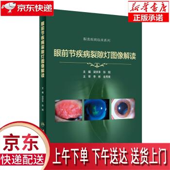 【新华畅销图书】眼前节疾病裂隙灯图像解读 梁庆丰,张阳 人民卫生出版社