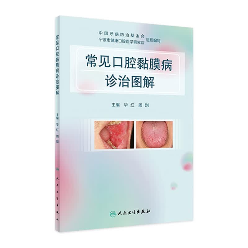 常见口腔黏膜病诊治图解