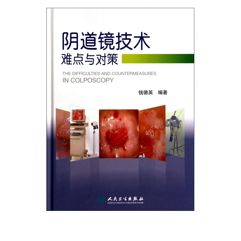 阴道镜技术难点与对策(精)