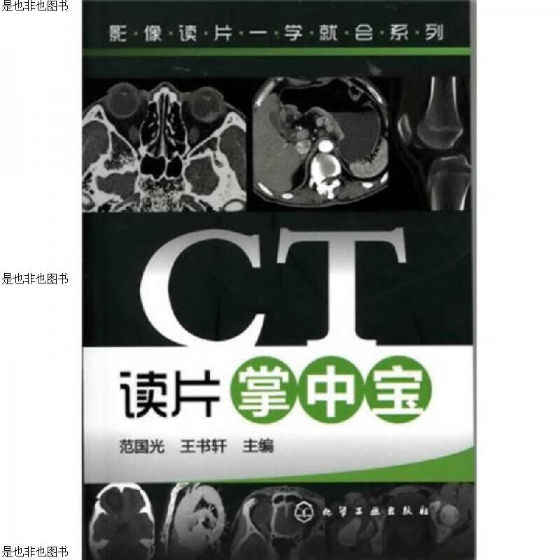 影像读片一学就会系列：CT读片掌中宝