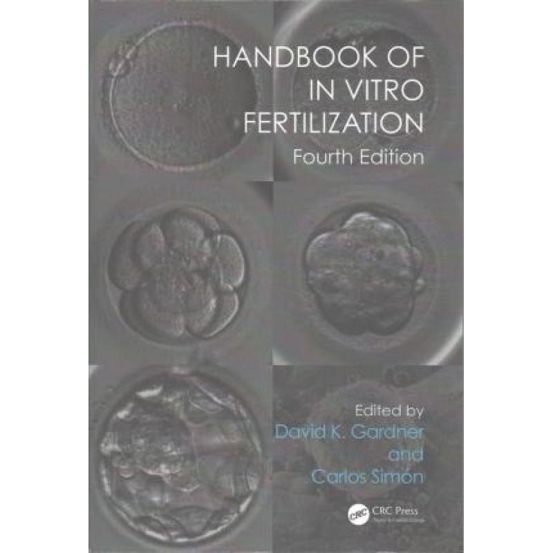 Handbook of in Vitro Fertilization