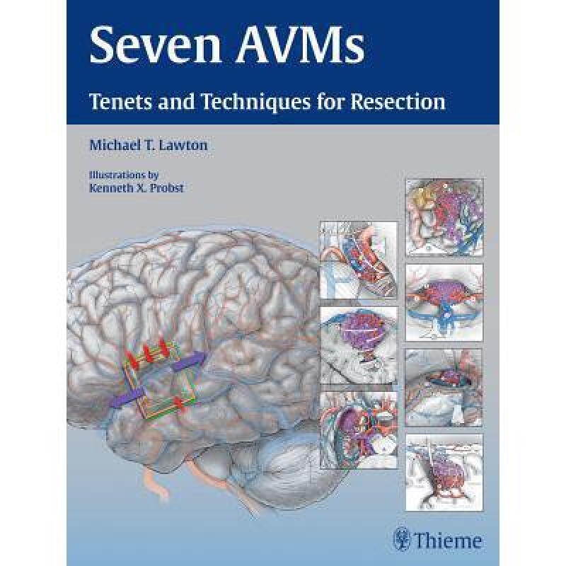 Seven Avms: Tenets and Techniques for Rese...