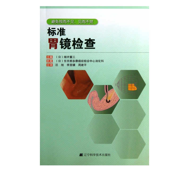 标准胃镜检查