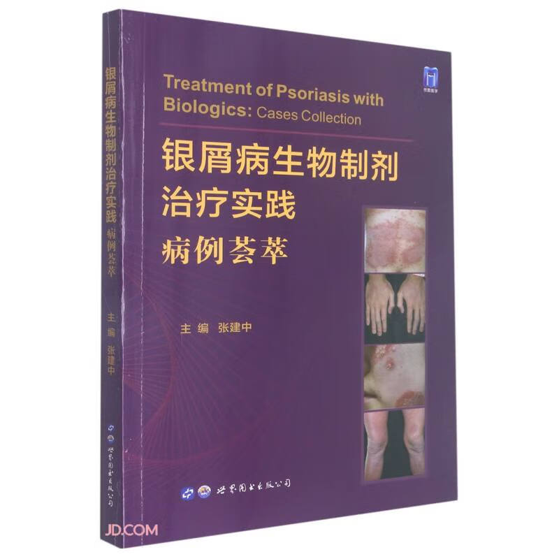 银屑病生物制剂治疗实践病例荟萃
