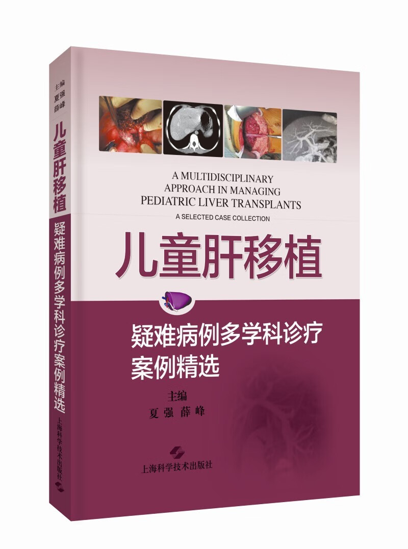 儿童肝移植：疑难病例多学科诊疗案例精选