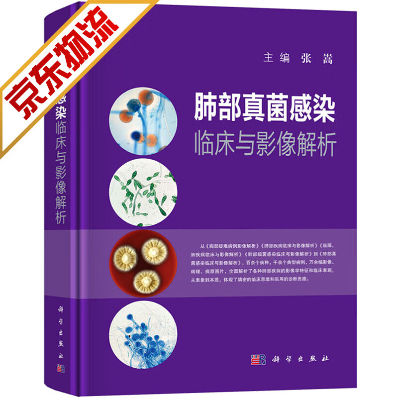 肺部真菌感染临床与影像解析
