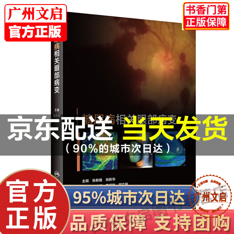 糖尿病相关眼部病变图书 医学 眼科学 红色