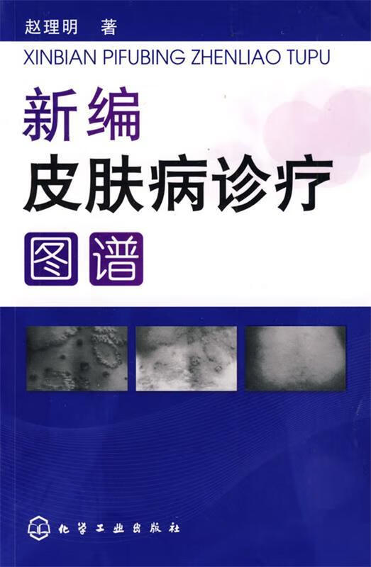 新编皮肤病诊疗图谱 赵理明著