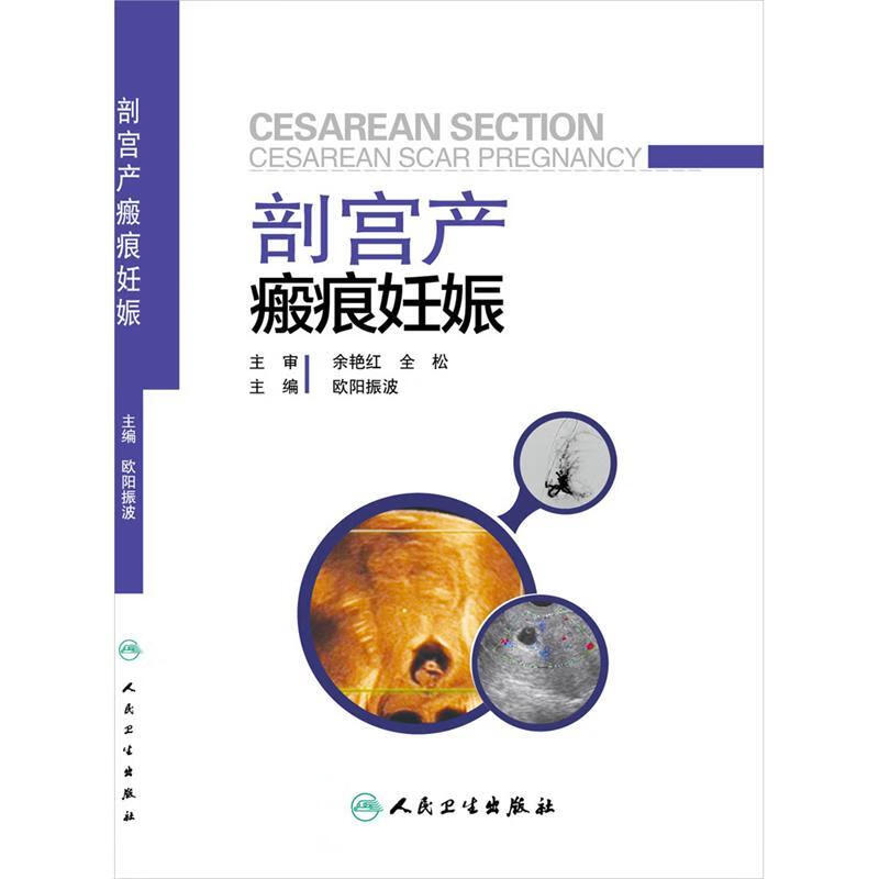 速发剖宫产瘢痕妊娠