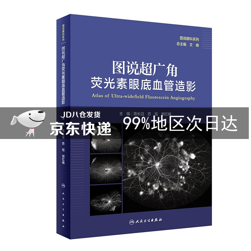 图说超广角荧光素眼底血管造影（图说眼科系列）