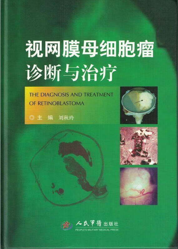 视网膜母细胞癌诊断与治疗