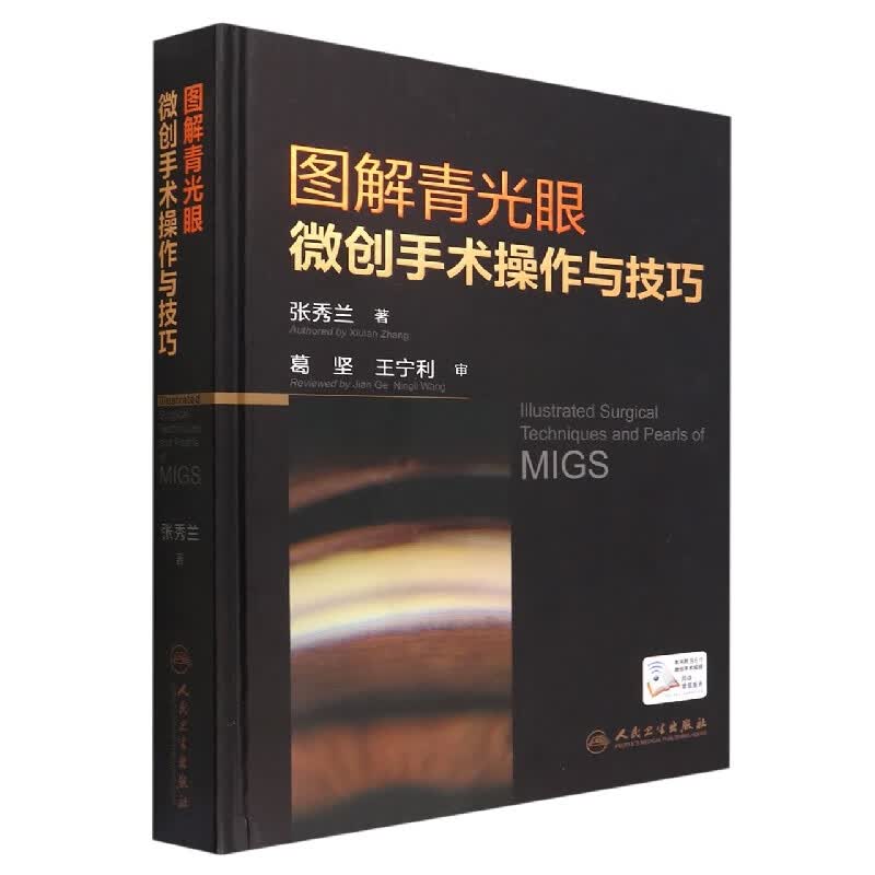 图解青光眼微创手术操作与技巧 张秀兰