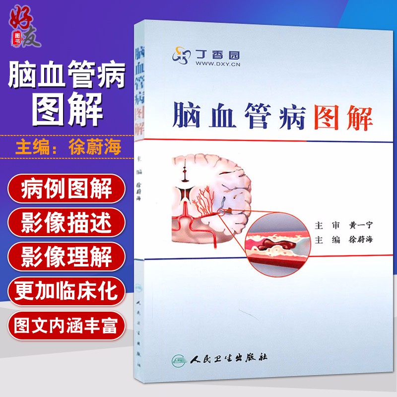 脑血管病图解 徐蔚海主编 人民卫生出版社9787117140041