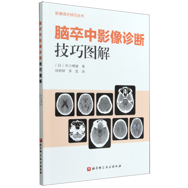 脑卒中影像诊断技巧图解/影像读片技巧丛书