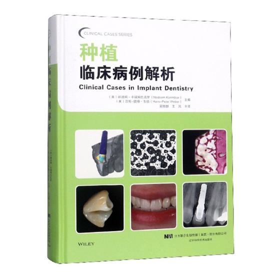种植临床病例解析 书籍分类 医学 口腔科学