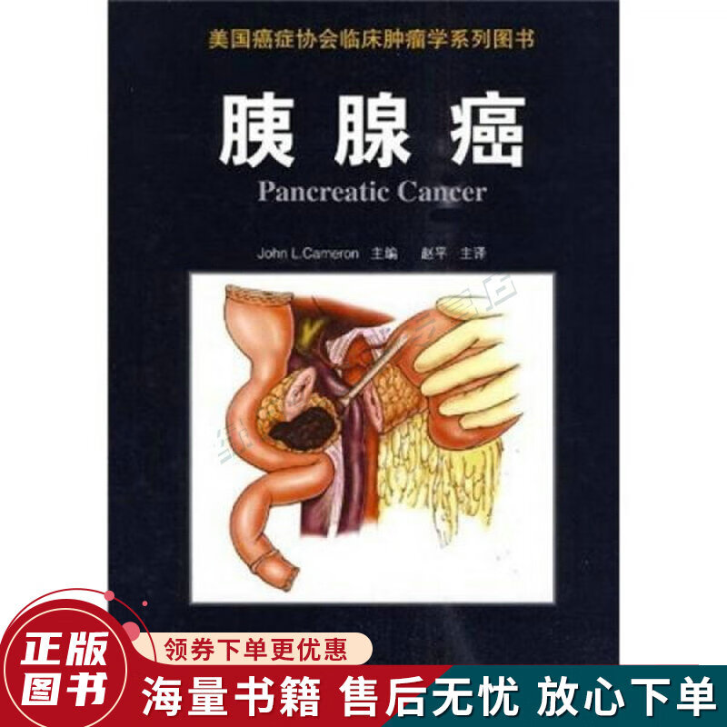 胰腺癌