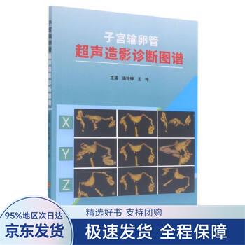 子宫输卵管超声造影诊断图谱 温艳婷,王仲 编 四川科学技术出版社