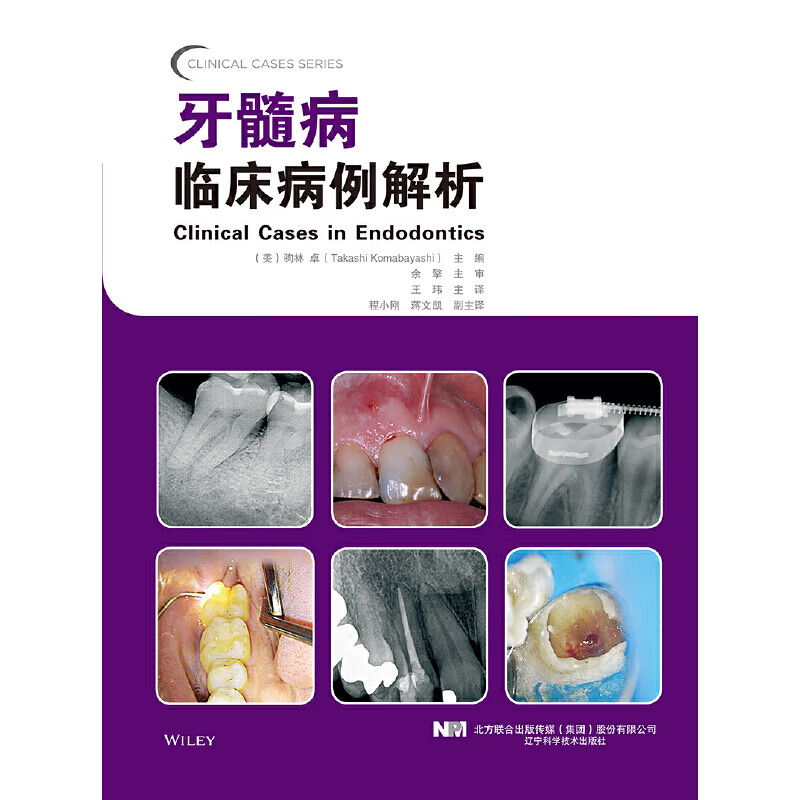 【现货】牙髓病临床病例解析