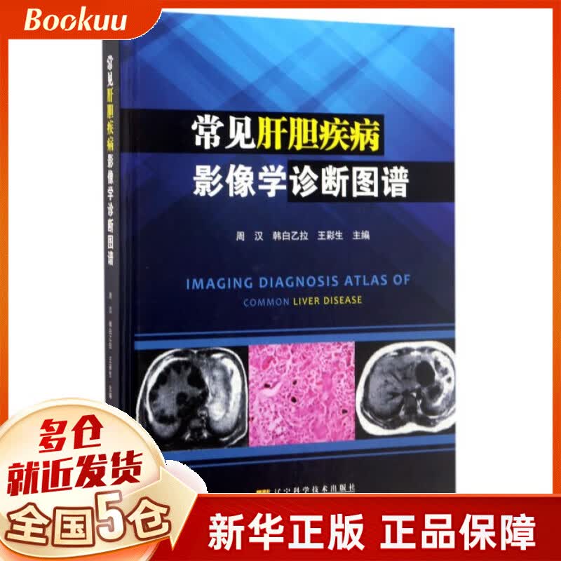 常见肝胆疾病影像学诊断图谱(精)